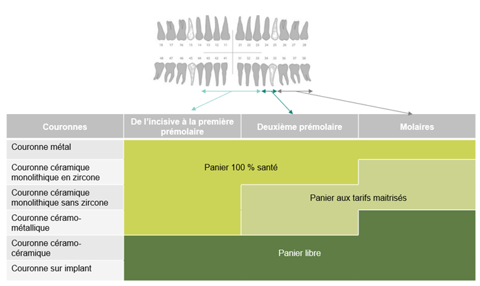 Réforme 100% santé : des réponses à vos questions – Swiss Life France